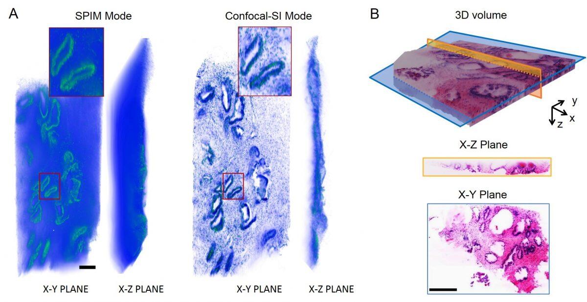 3d Histopathology Using Light Sheet Microscopy Translational